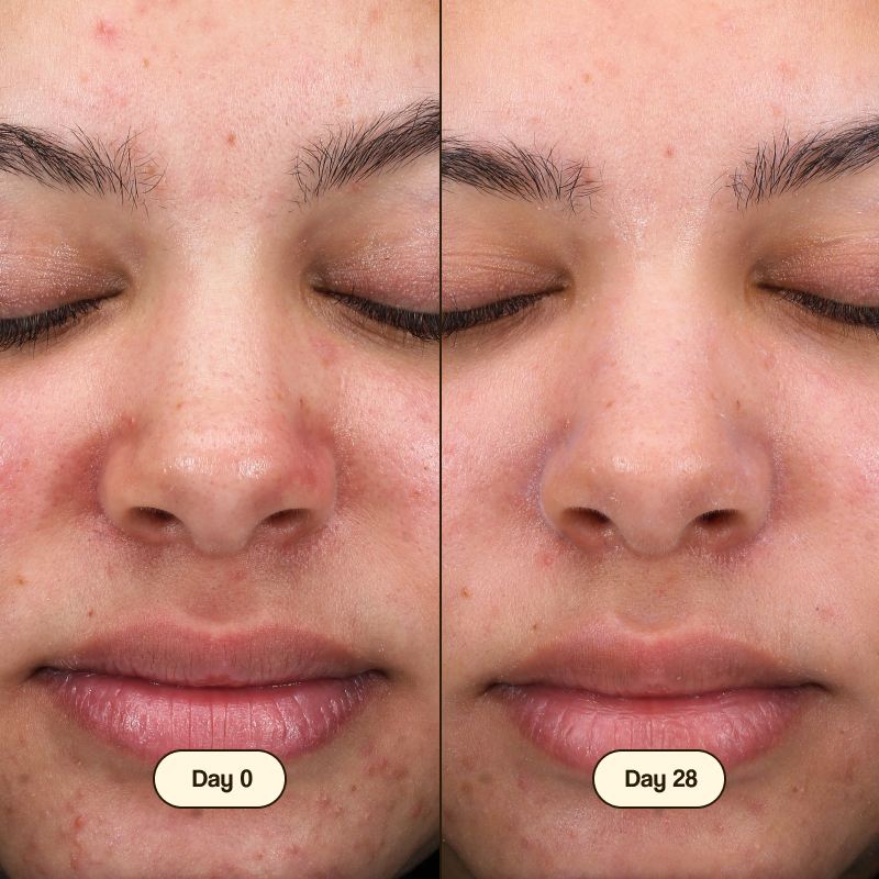 Salicylic acid facial cleanser | Freshly Cosmetics